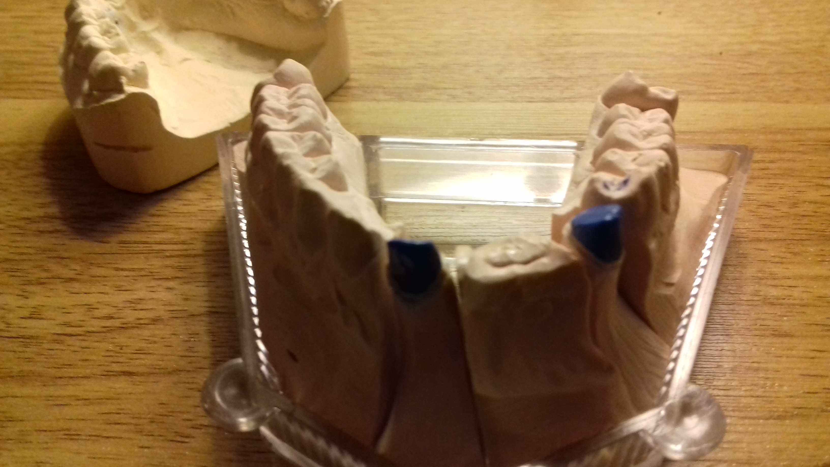 Teeth – pifl